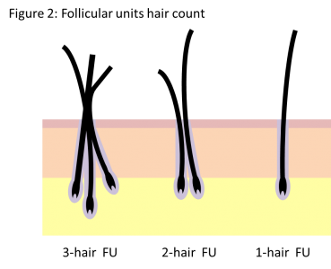 Hair Follicles can be in groups of 1-3, with rare instances of 4 or 5!